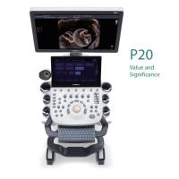 China Sonoscape Portable Color Doppler Ultrasound Sonoscape S22 Ultrasound Machine Sonoscape P20 Doppler Ultrasound for sale