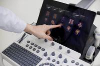 China Cardiovascular Sonoscape P50 Ultrasonido Doppler Ultrasound Machine for sale