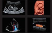 China High Quality Sonoscape 4d 3d Ultrasound Machine Ultrasonido Veterinariy Human Ultrasounde Scanner for sale