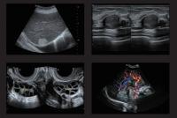 China High Quality Sonoscape 4d 3d Ultrasound Machine Ultrasonido Veterinariy Human Ultrasounde Scanner for sale