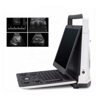 China Hot Slaes Ecografo Portatil Sonoscape E2 Ultrasonido Portatil for sale