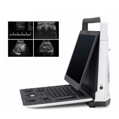 China Hot Slaes Ecografo Portatil Sonoscape E2 Ultrasonido Portatil for sale