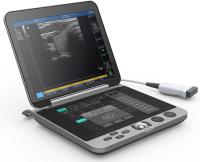 China High Resolution  Laptop B/W Ultrasound MSK  Ultrasound Scanner  Laptop Ultrasound Machine for sale