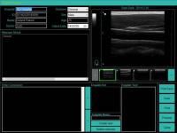 China High Resolution  Laptop B/W Ultrasound MSK  Ultrasound Scanner  Laptop Ultrasound Machine for sale