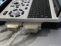 China Digital Human Veterinary Portable Ultrasound Machine Ultrasound Portable Ultrasound for sale