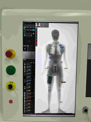 China 0.85KW Full Body X Ray Scanner Fast Installation People Screening System for sale
