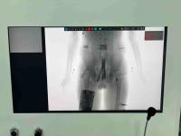 China Micro-dose X-ray Security Full Body Scanner Dual View High Resolution for sale