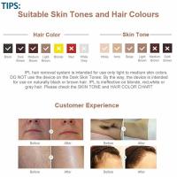 China Skin Rejuvenation 4cm² 60W Home Laser Hair Removal Device for sale
