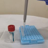 China Nasal Flocked Swab Viral Preservation Reagent Sample Release in 5 Seconds without Extraction Direct PCR for sale