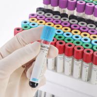 China Vacuum EDTA Blood Tubes for Complete Blood Count (CBC) – High Quality, Secure Seal for sale