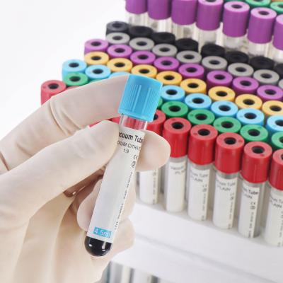 China Vacuum EDTA Blood Tubes for Complete Blood Count (CBC) – High Quality, Secure Seal for sale