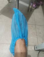 China Disposable Non-woven Shoe Covers Hospital Grade Skid-resistant Tread for sale