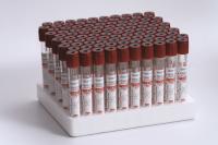 China CE Approved Red Top No Additive Plain Tube Vacuum Blood Sample Collection Tube According Vacuum for sale