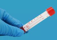 China Disposable 10ml Virus Sampling Kit Nucleic Acid Extraction Kit for sale