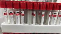 China JINGZ/YBK Blood Sample Collection Tube for Medical / Laboratory for sale