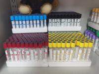 China Medical Sodium Citrate Tube Essential For Laboratory Research for sale