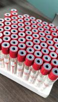 China Manufacturer Plain Tube Vacuum Blood Sample Collection Tube Medical Blood collection 2ml3ml5ml for sale