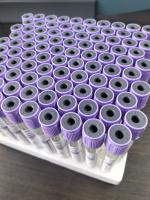China CE Approved K2 EDTA Tube Purple top cap medical blood collection tube Type 1ml-10ml for sale