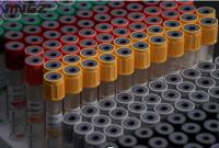 China Orange Or Red Cap Pro-coagulation Tube With Clot Activator 4ml 5ml 6ml Blood Test Tube for sale