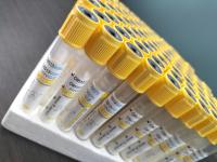 China Gel Clot Activator Tube For Medical Blood Collection Tubes 2ml 5ml for sale