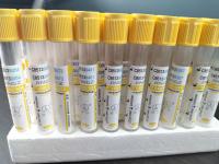 China Medical Gel And Clot Activator Golden Blood Sampling Tubes With CE 2ml-10ml for sale