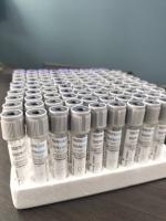 China Grey Cap Glucose Tube 2ml-10ml For Medical Blood Collection Vacuum Tube for sale