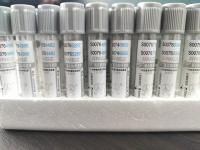 China Grey Cap Glucose Tube 2ml-10ml For Medical Blood Collection Vacuum Tube for sale