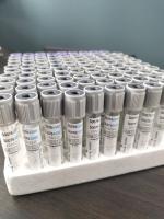 China Grey Cap Glucose Tube 2ml-10ml For Medical Blood Collection Vacuum Tube for sale