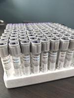 China Grey Cap Glucose Tube 2ml-10ml For Medical Blood Collection Vacuum Tube for sale