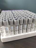 China Grey Cap Glucose Tube 2ml-10ml For Medical Blood Collection Vacuum Tube for sale