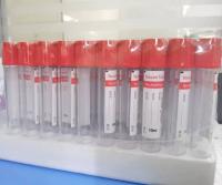 China 16*100mm 10ml No Addictive Tube Vacuum Blood Test Tube for sale