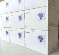 China Colloidal Gold Method Covid 19 Antigen Test Kit 15 Minutes Quick Test for sale