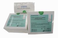 China High Accuracy Rapid Antibody Test Kit Serum Plasma Whole Blood IgG/IgM Raoid Test Kit for sale