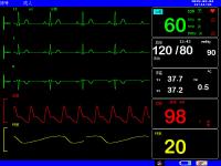 China ISO CE ICU Patient Monitor 12.1