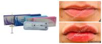 China Injectable Hyaluronic Acid Gel For Wrinkles Knee Injections Eyes Wrinkles Neck Lines for sale