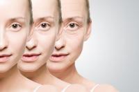 China Hyaluronic Acid Lip Gel Injections Eye Wrinkle Synthetic Hyaluronic Acid Dermal Filler for sale
