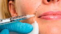 China 50ml Injectable Hyaluronic Acid Dermal Facial Chin Filler With Lidocaine PCL Plla Filler Injection for sale