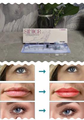 China SIMIER Medical Anti-Aging Dermal Filler 2ml Hyaluronic Acid Gel for Wrinkle Treatment for sale