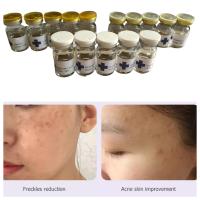 China Hyamely Non Cross Linked Hyaluronic Acid Mesotherapy Solution 5ml for Skin Hydration for sale