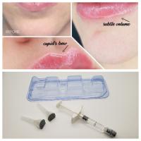 China 2ml Cross Linked Dermal Filler High HA Concentration 24mg/ml Anti Wrinkle Injectable for sale