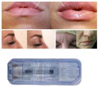 China SIMIER Cross Linked Hyaluronic Acid Dermal Filler 2ml Lip Face Wrinkle Correction for sale