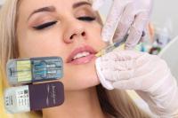 China Deep 2ml 1ml Hyaluronic Acid Lip Fillers Injectable Female OEM ODM for sale