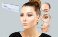 China Hyaluronic Acid Dermal Filler 1ml for Cheek Augmentation and Wrinkle Correction for sale