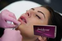 China Cross Linked HA Dermal Filler 1ml Injectable Lip Fillers for Cheeks Chin Nasolabial Folds for sale