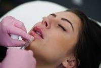 China Cross Linked Hyaluronic Acid Dermal Filler Juvederm Ultra 3 1ml x 2 for Lip Injections for sale