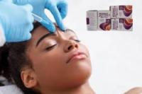 China Allergan Botox Botulinum Toxin 100 Units Anti Wrinkle Injection Powder for Forehead Lines for sale