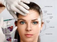 China Anti Aging Anti Wrinkle Botulinum Toxin Type A Allergan Botox Powder 100U for sale