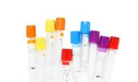 China Capillary Tubos Vacutainer Blood Collection Accessories Red Plain Vacuum Tube for sale