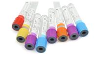 China 7ml 8ml Gel Vacutainer Blood Collection Accessories Yellow Top Acd Tube for sale