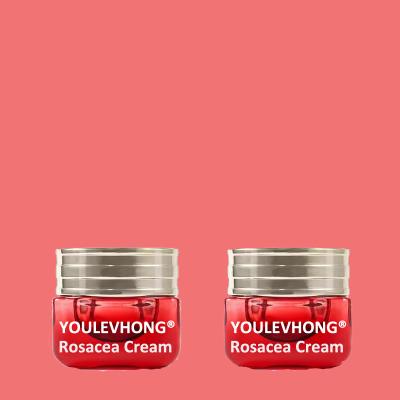 China YOULEVHONG Rosacea Cream Soothes and Hydrates Paraben Free Fragrance Free for All Skin Types for sale